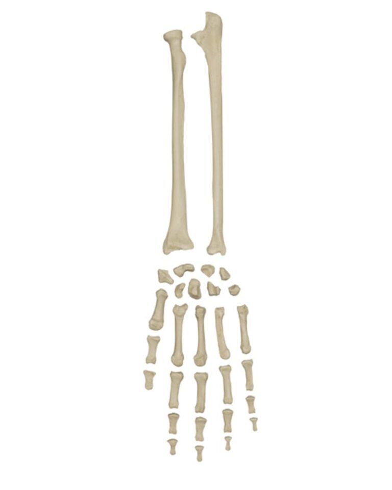 Disarticulated Skeleton with Carrying Case - Osta International