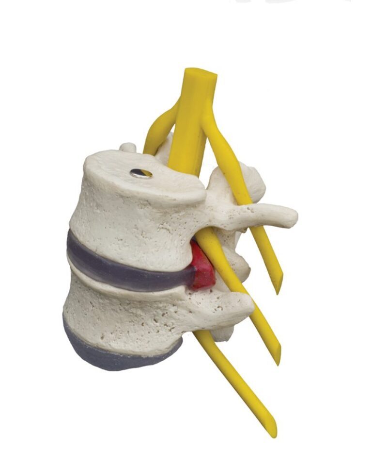 Pathology - Model - Osta International