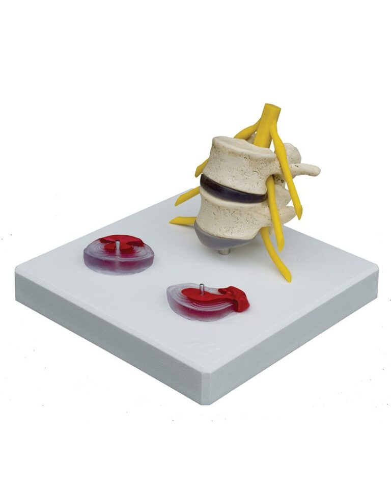 Pathology - Model - Osta International