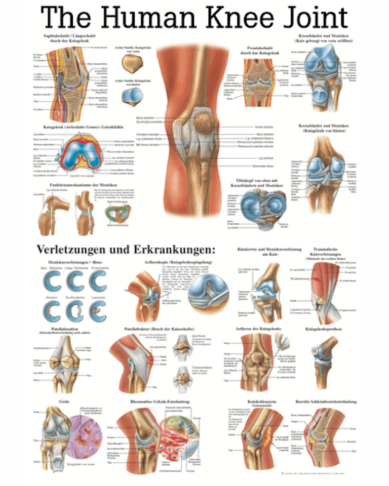 The Human Knee Joint Anatomical Chart - Osta International