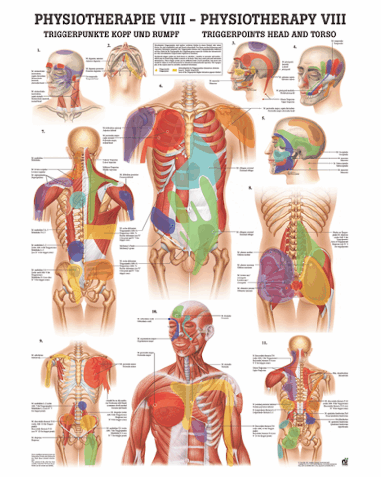 Physiotherapy VIII Triggerpoints Head and Torso Anatomical Chart - Osta ...