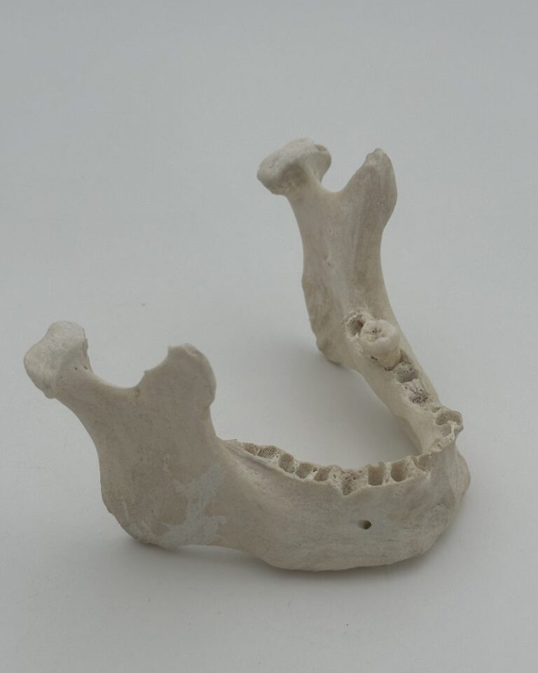 Natural Adult Mandible No Teeth - Osta International