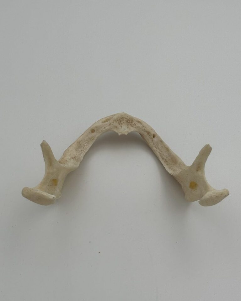 Edentulous Mandible - Osta International