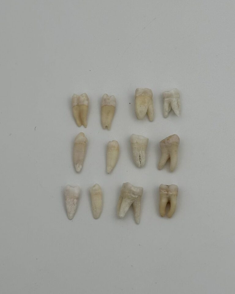 Individual Teeth - Osta International