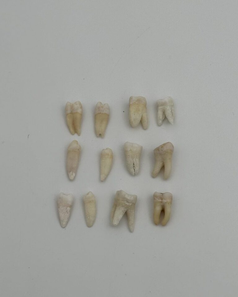 Individual Teeth - Osta International
