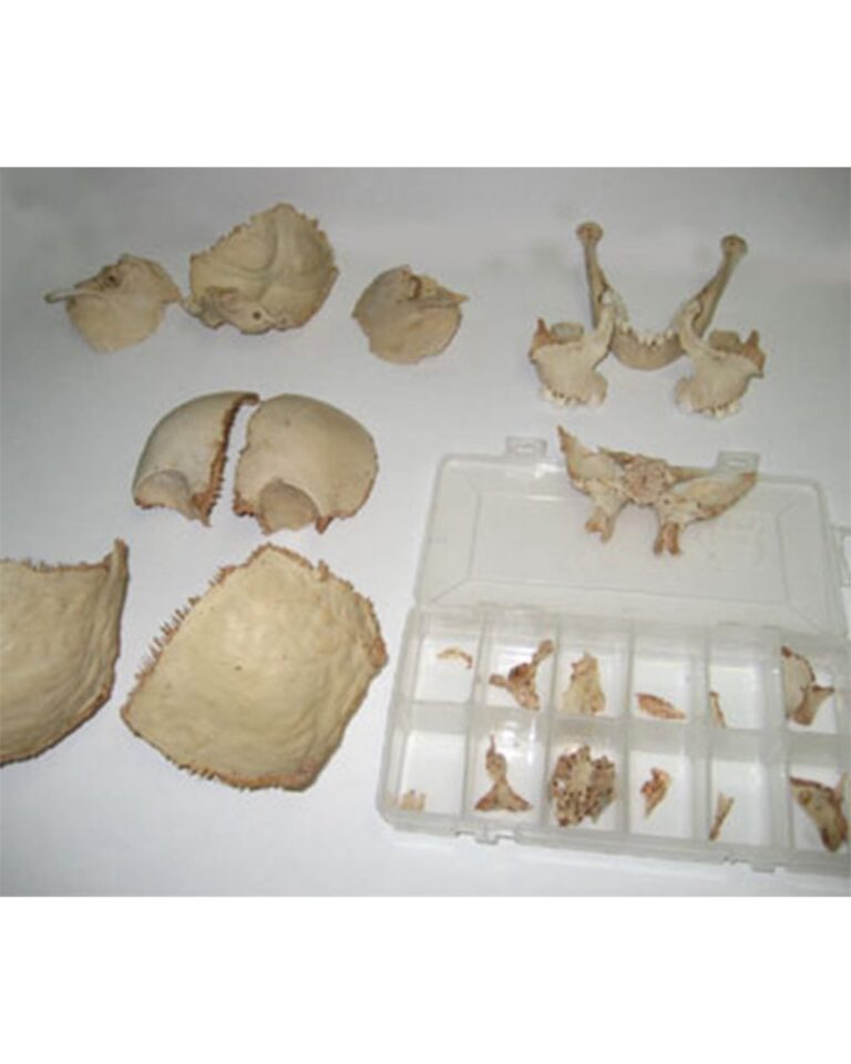 Real Human Disarticulated Skull - Osta International