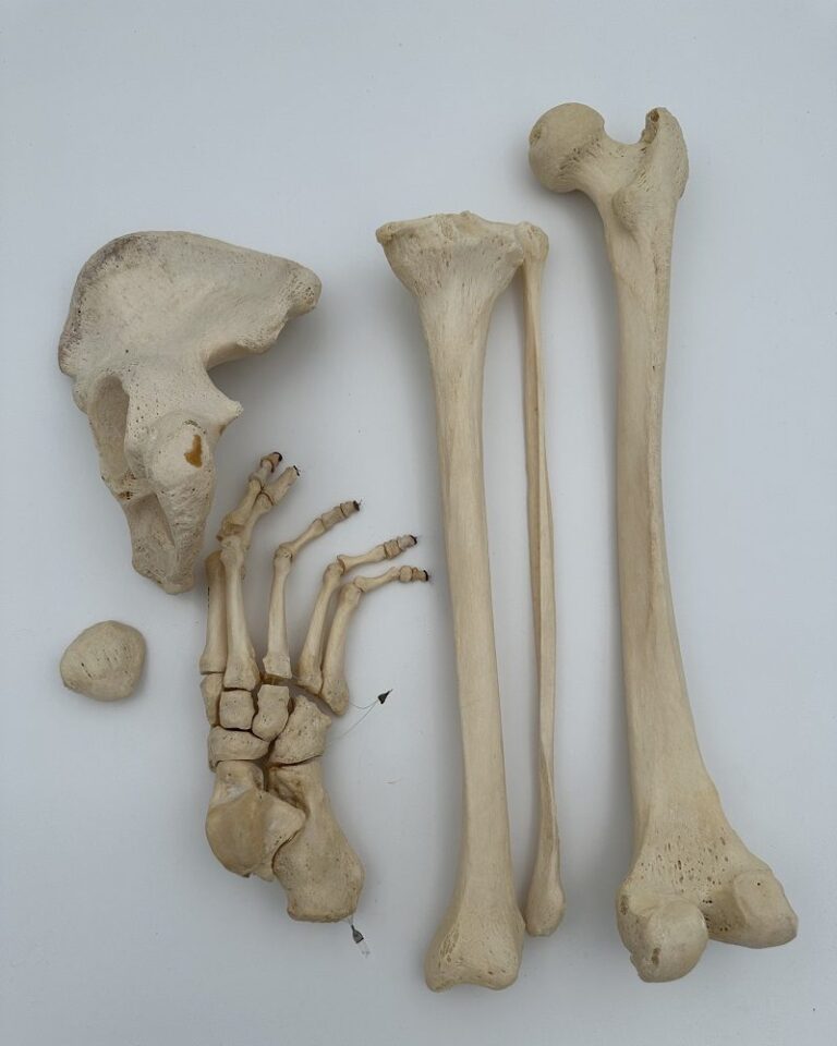 Lower Extremity - Osta International