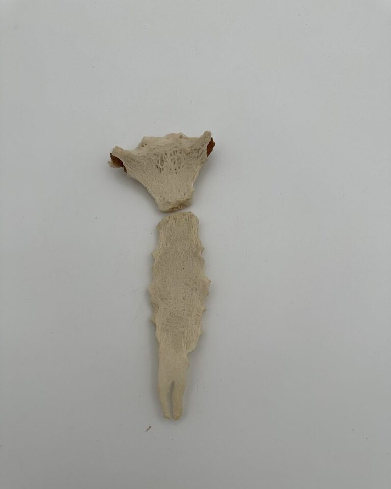Sternum Manubrium - Osta International