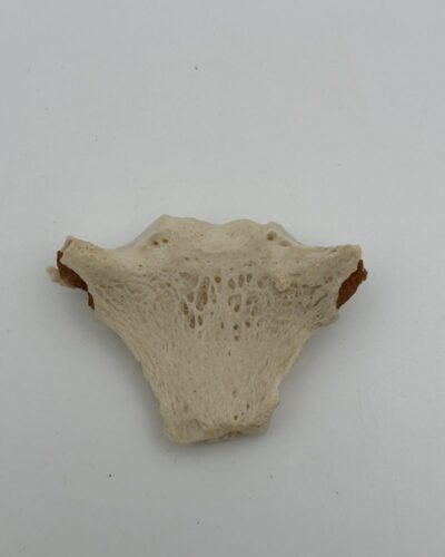 Sternum Manubrium - Osta International