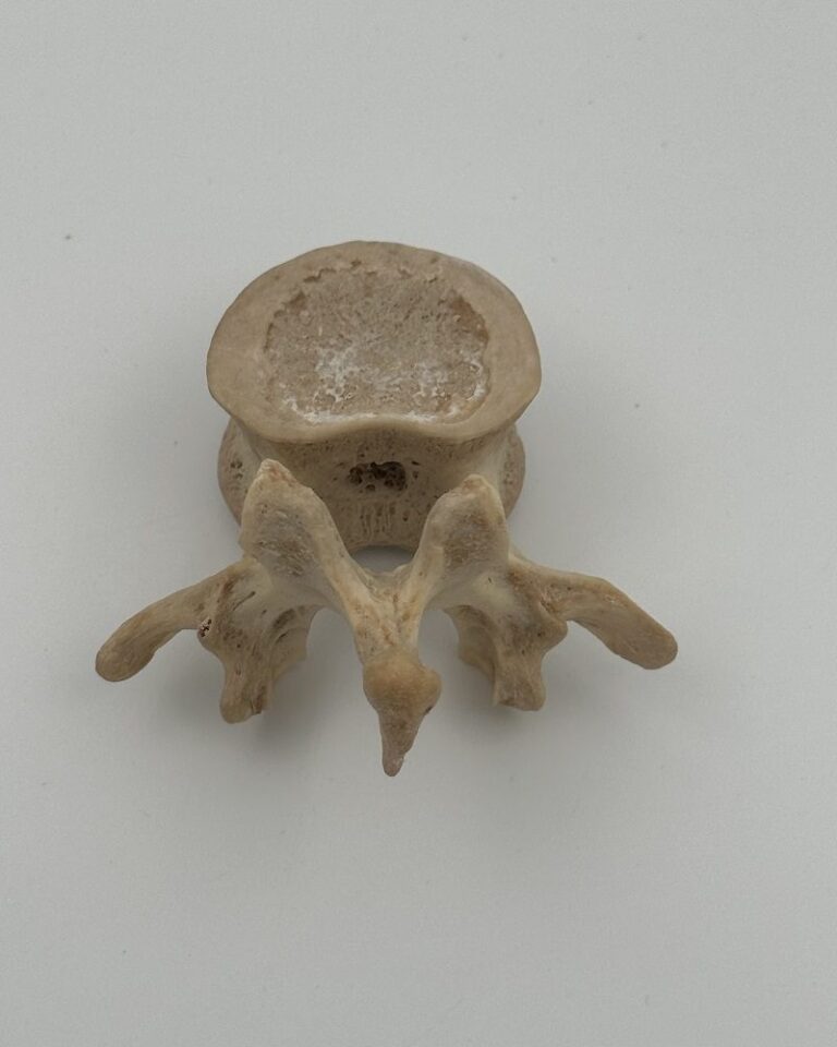 Lumbar vertebrae - Osta International