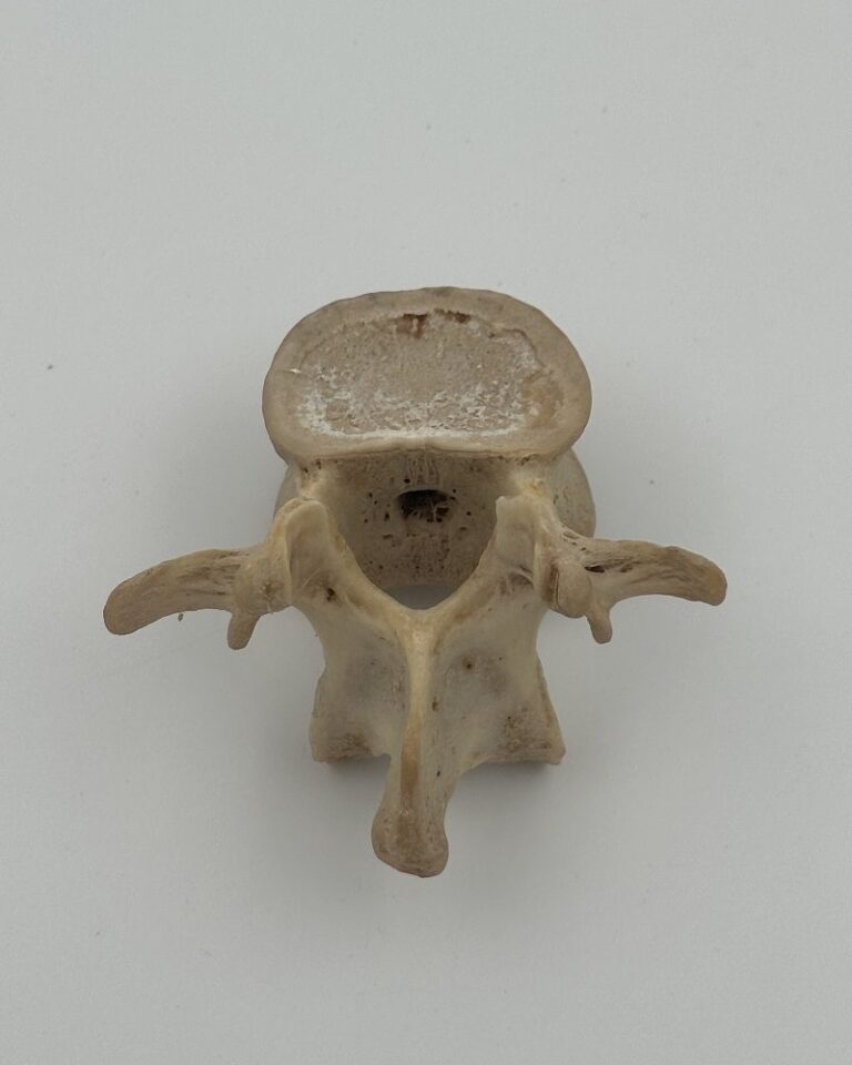 Lumbar vertebrae - Osta International
