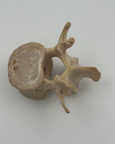 Lumbar vertebrae - Osta International