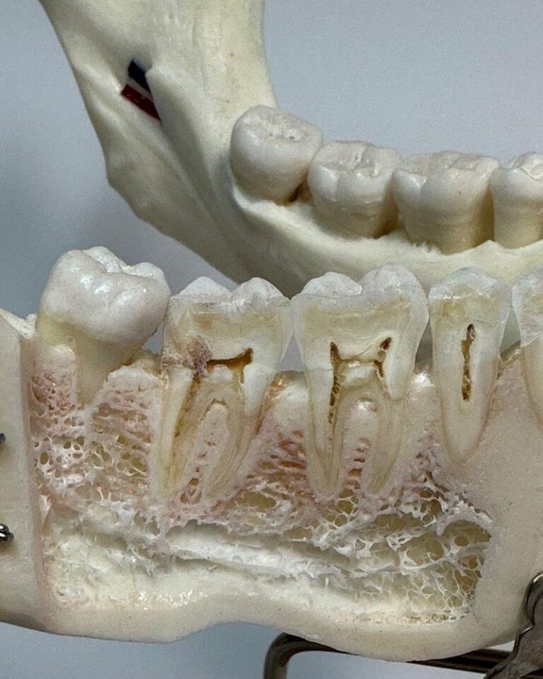Adult Mandible on Stand - Osta International
