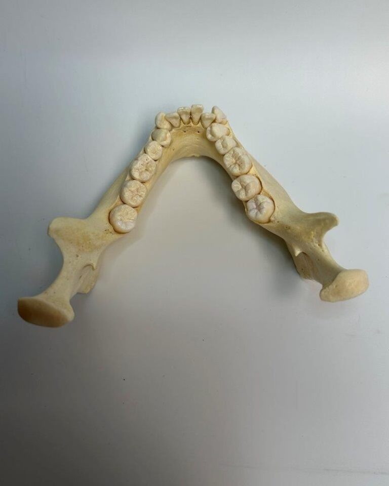 Male Skull with Severe Underbite - Osta International