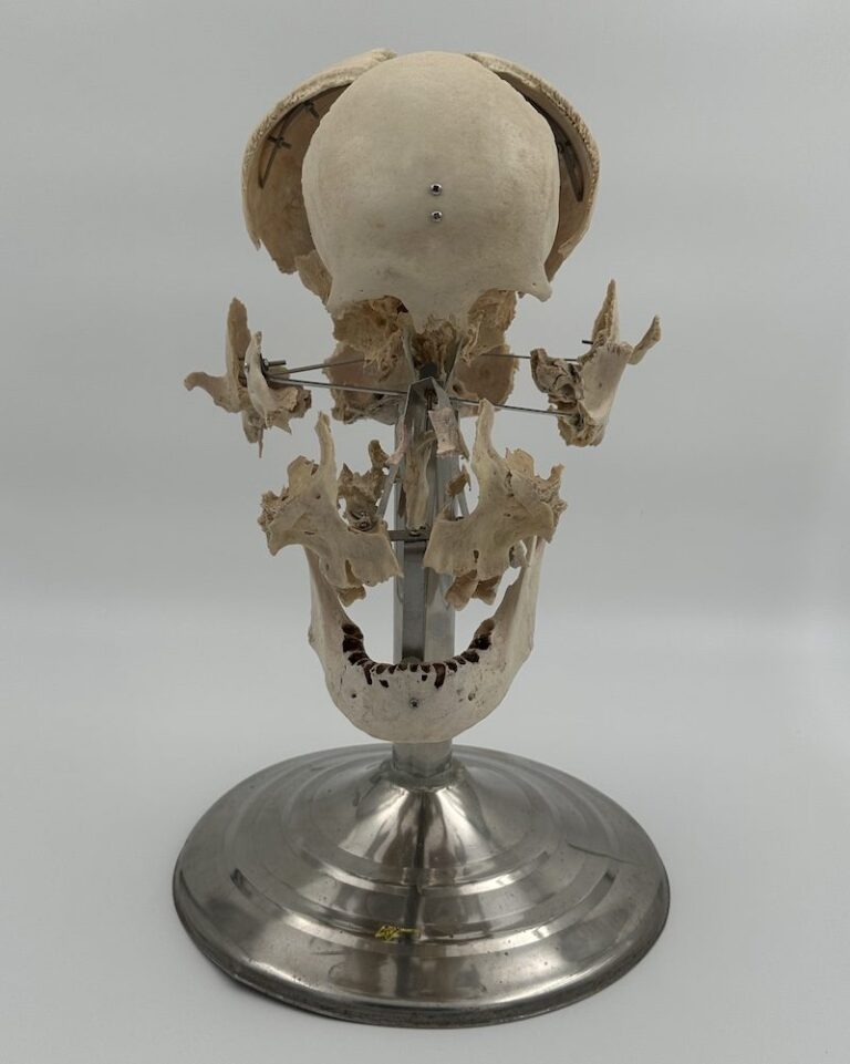 Human Skull Beauchene Model - Osta International