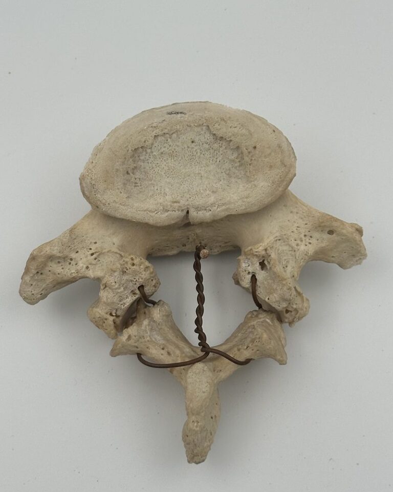 Human Lumbar Vertebrae - Osta International