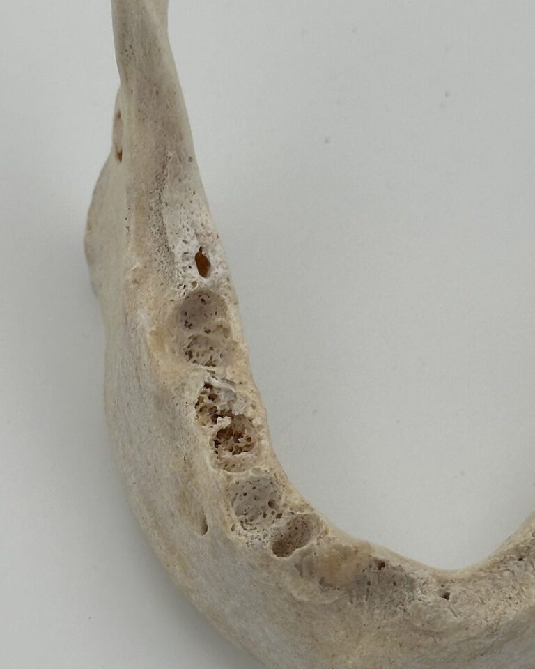 Mandible - Osta International